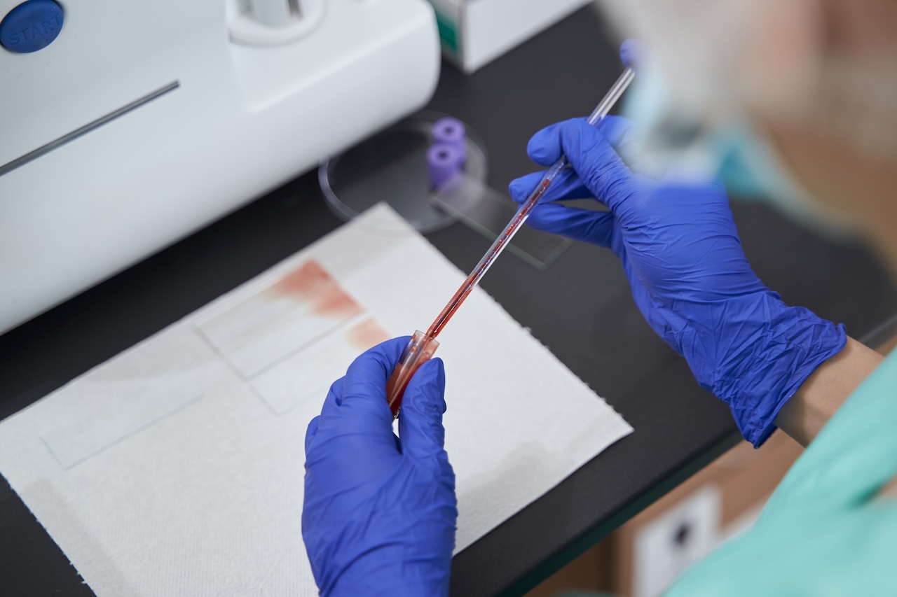 How Often Should You Get Blood Work Done? - mmminimal